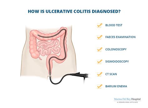Ulcerative Colitis Diagnosis Noster Probiotics