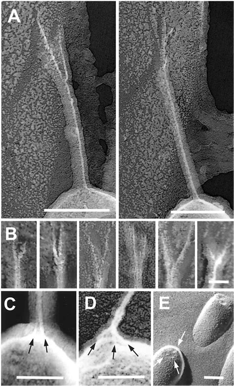 Figure 1 From Corrections Semantic Scholar