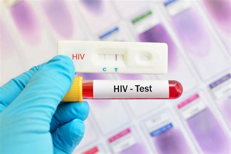 How To Read STD Test Results STD Free Los Angeles
