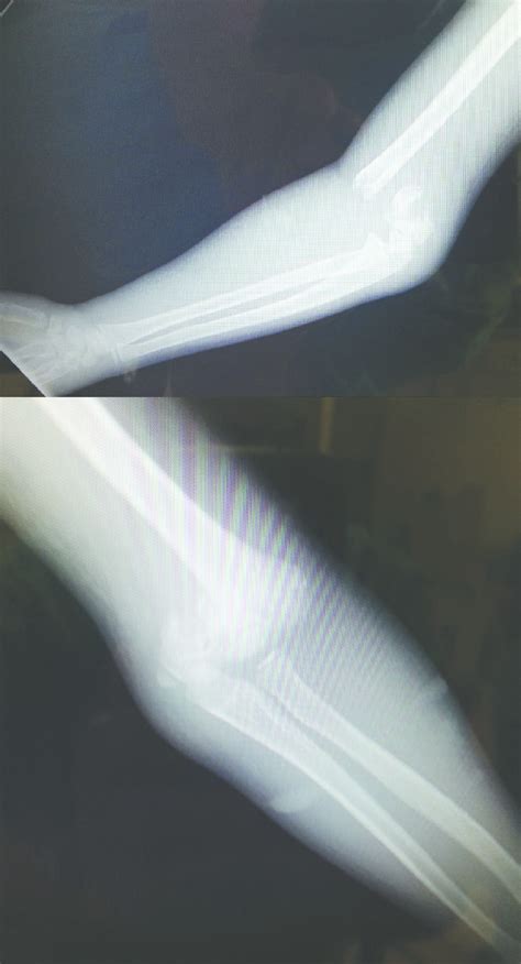 Preoperative X Ray Views Download Scientific Diagram