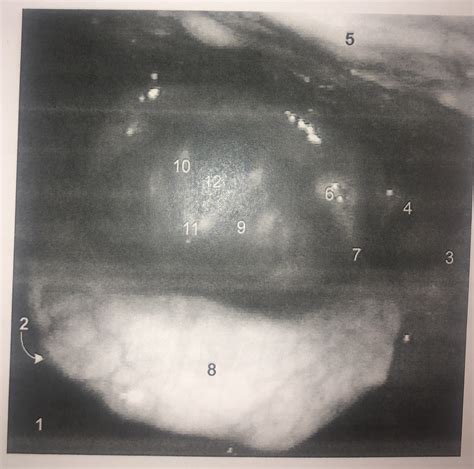 Scope Diagram Quizlet Scope Diagram Quizlet