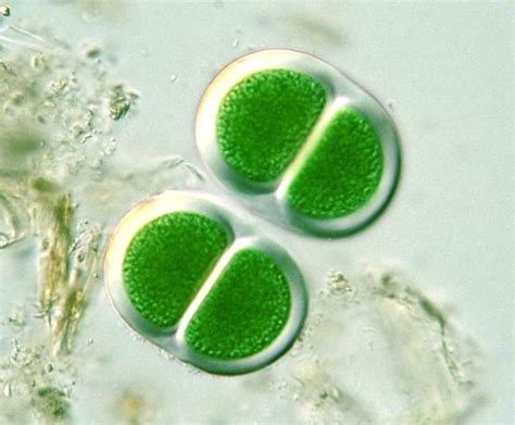 Prokaryote Chroococcales Chroococcus Turgidus