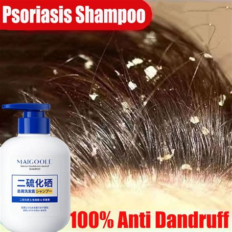 Original Selenium Disulfide Anti Dandruff Cream For Scalp Psoriasis