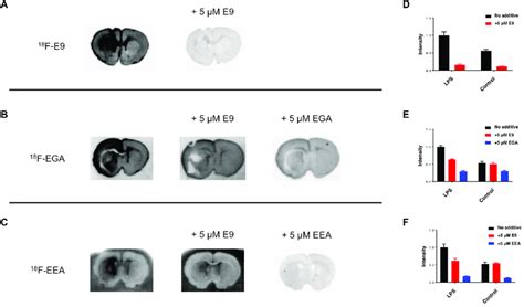 In Vitro Autoradiography In Rat Brain Sections Of Neuroinflammation
