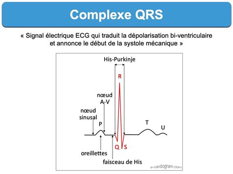 qrs complex of ecg signal download scientific diagram
