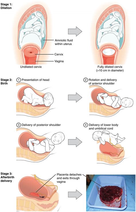 Dilated Cervix Diagram