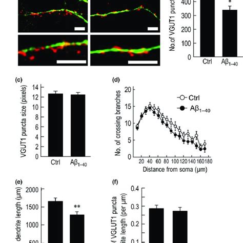 quantification of synapse number using puncta analyzer shown here is
