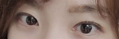 자연유착 쌍꺼풀 후기 쌍수 후 붓기 쌍수 후 화장 쌍수 후 온찜질 등 관리 방법 네이버 블로그