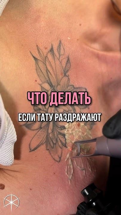 ЧТО ДЕЛАТЬ НСЛИ ТАТУ РАЗДРАЖАЕТ Youtube