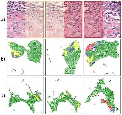 A Images From The Bcss Dataset With Overlapping Regions Cropped Download Scientific Diagram