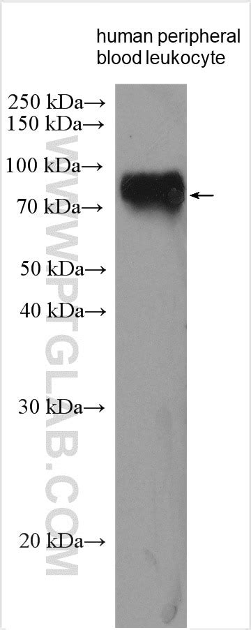 Lilrb3 Antibody 18260 1 Ap Proteintech