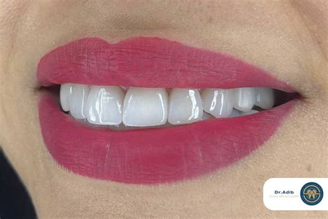 گالری دندانپزشکی دکتر ادیب