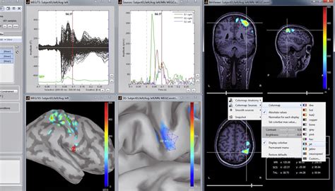 Brainstorm Matlab Open Source Application For Megeeg Data Analysis