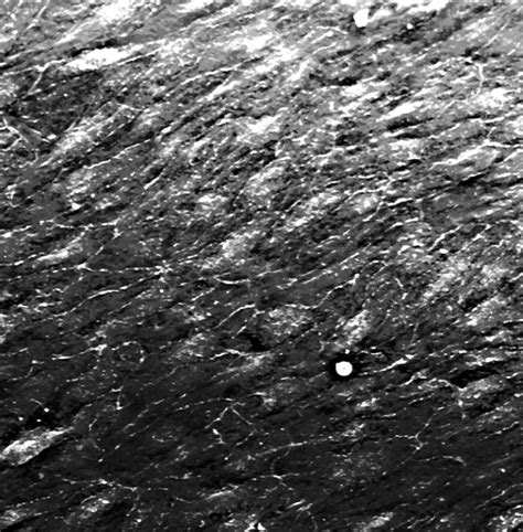 Adhesion And Aggregation Platelet Research Laboratory