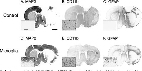 Figure 1 From Intracerebroventricular Injection Of Microglia Protects Against Focal Brain