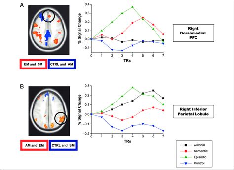 Activations Common To Two Memory Conditions Areas With Increased
