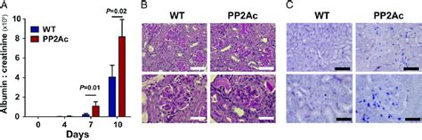 Increased Levels Of Pp2ac Promote Organ Damage And Neutrophil