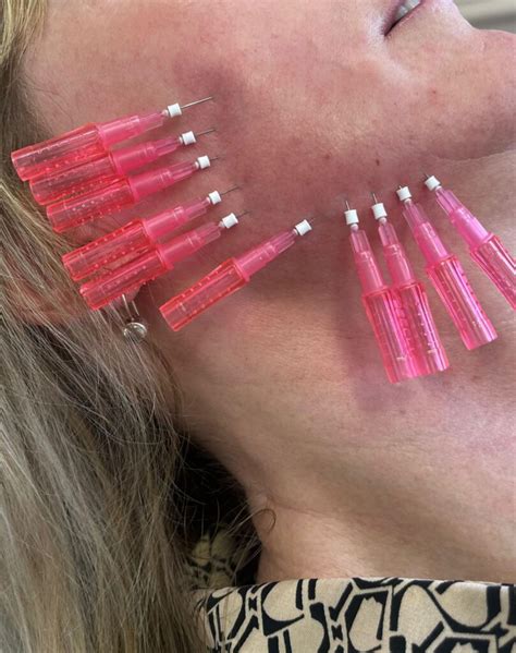 Pdo Mono Threads Abbie Victoria Aesthetics