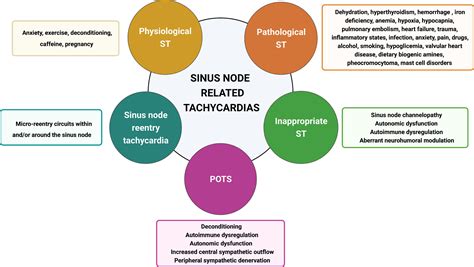 Treatment Of Sinus Tachycardia Sinus Tachycardia Definition Vnmd