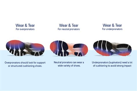Supination Shoe Wear Pattern