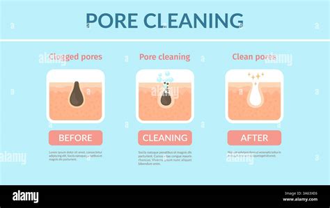 Skin Pore Cleaning Vector Face Care Blackhead Acne Treatment Beauty