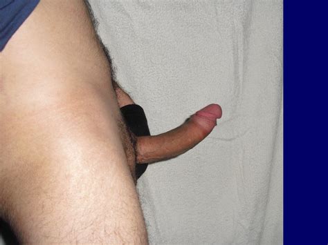Tipos De Pene Según Morfología Las Experiencias De Toulouse