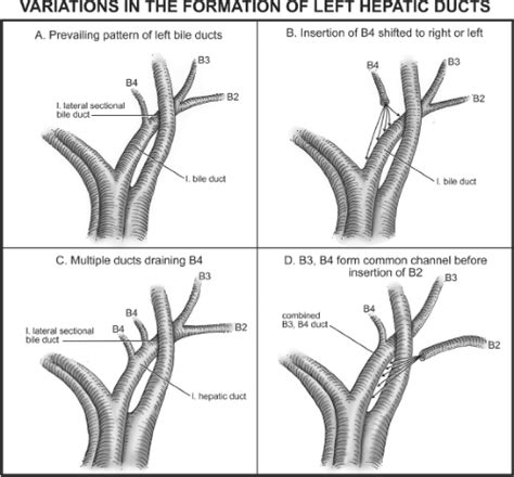 Reconstruction Of The Bile Duct Anatomic Principles And Surgical Techniques Basicmedical Key
