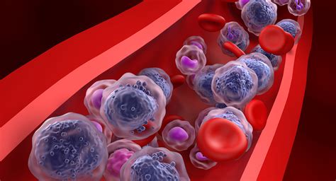 Md Anderson And Rigel Collaborate To Advance Olutasidenib In Aml Ut
