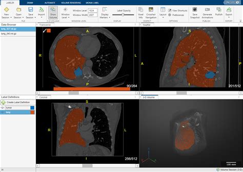 Medical Image Labeler Interactively Explore Label And Publish