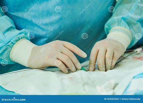 Catheter Interventional Radiology At Amy Heyer Blog