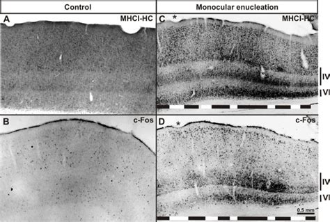 primary visual cortex reveals a banded pattern of mhci hc and c fos