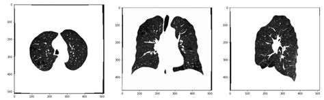 Get The Same Views Of 3d Dicom Image Algorithms Itk
