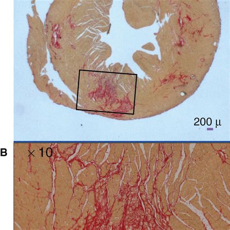 3d Reconstruction Of The Fibrotic Tissue From Segmented Histological Download Scientific
