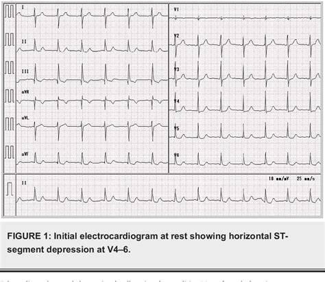 Figure 2 From Anaphylactic Shock Due To Technetium 99mtc Tetrofosmin During Myocardial
