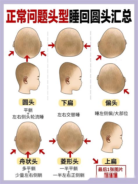 宝宝头型教你如何睡出小圆头 常见正常问题头型特征 知乎