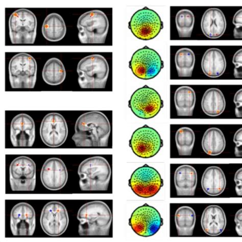 Pdf Applications Of Second Order Blind Identification To High Density