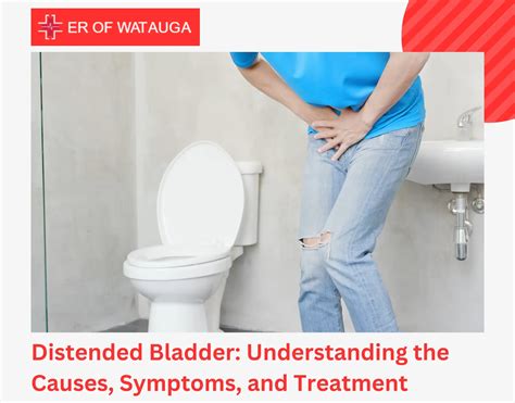 Distended Bladder Understanding The Causes Symptoms And Treatment