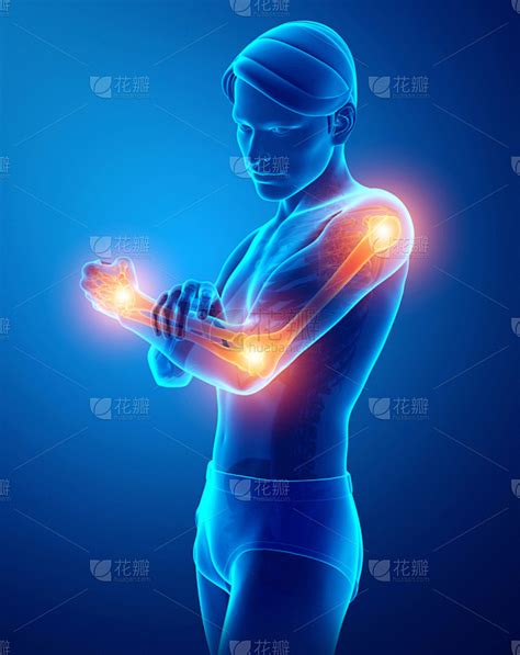 痛苦 关节 手臂 男人 断胳膊 肘 手腕 人类肌肉 生物医学插图 垂直画幅