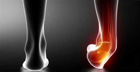 5 სასარგებლო ვარჯიში ჯანსაღი და ლამაზი ტერფებისთვის