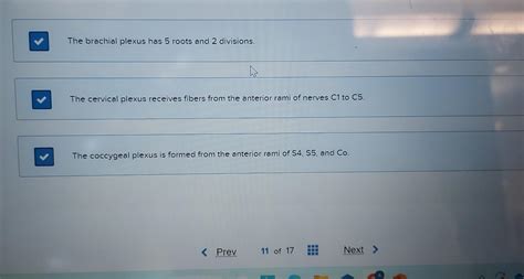 Solved Which Of The Following Statements Is Are True