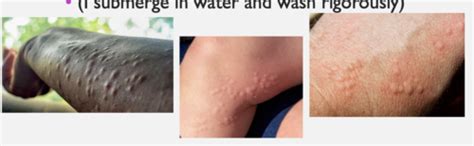 Exam Specialized Erythema Flashcards Quizlet