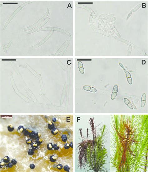 Morphology Of Fusarium Circinatum And Symptoms A Macroconidia Download Scientific Diagram