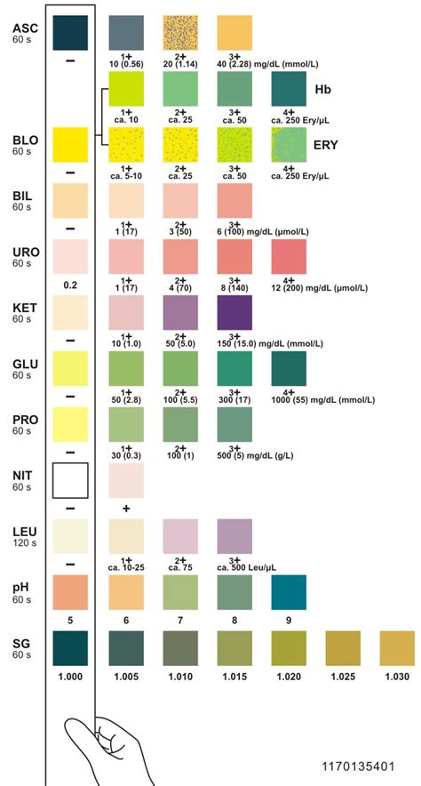 Urinalysis Test Strip Color Chart Porn Sex Picture