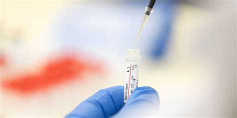 Cell Chex Cerebrospinal Body Fluid Control Streck