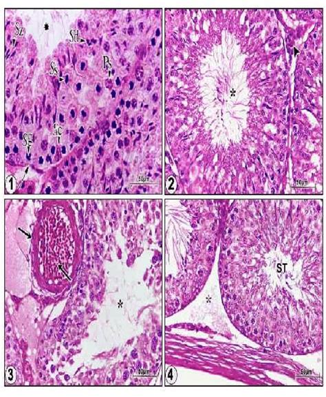 Photomicrograph Of Testis Sections Of The Control Rats Hx And E Download Scientific Diagram