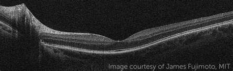 Optimizing Oct Spectrometer Performance Wasatch Photonicswasatch Photonics
