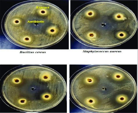 Susceptibility Of Bacteria To The Methanol Bark Extract Of Cordia Myxa Download Scientific