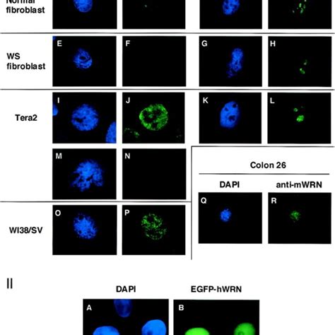 Comparison Of Levels Of Wrn Helicase Expression In Cells Of Normal Download Scientific Diagram