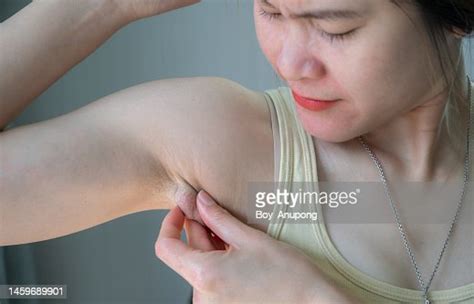 Swollen Lymph Nodes In Armpit Women Swollen Lymph Nodes Causes