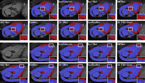 visualizations of different methods for cardiovascular mr segmentation